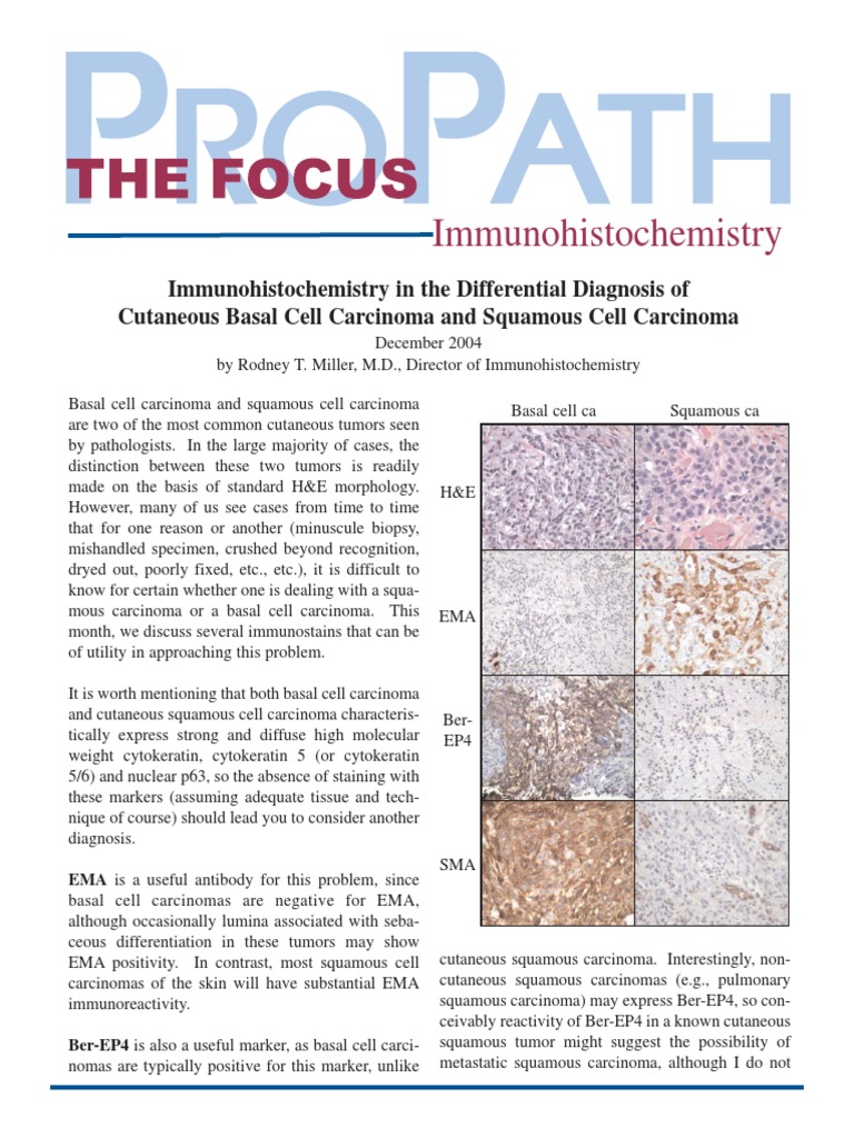 Basal Cell Vs Squamous Pdf Carcinoma Immunohistochemistry