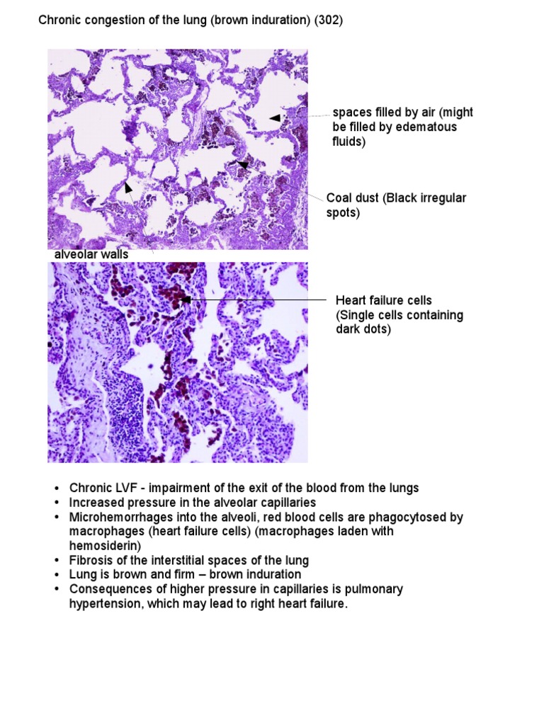 Respiratory System Pathology (Part 1) | Lung | Respiratory System