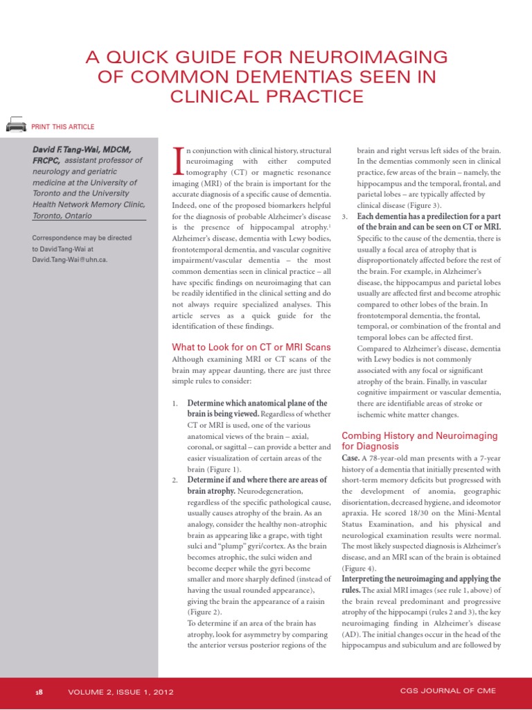 A Quick Guide For Neuroimaging of Common Dementias Seen in Clinical ...