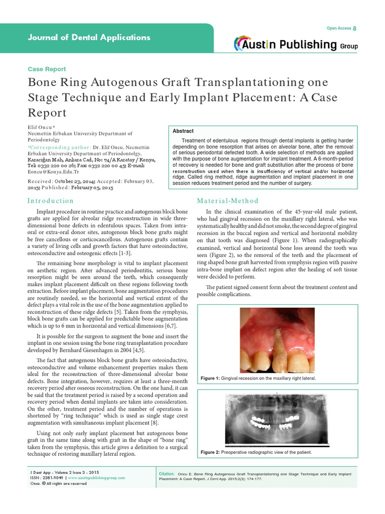 Bone Ring Autogenous Graft Transplantationing one Stage Technique and ...
