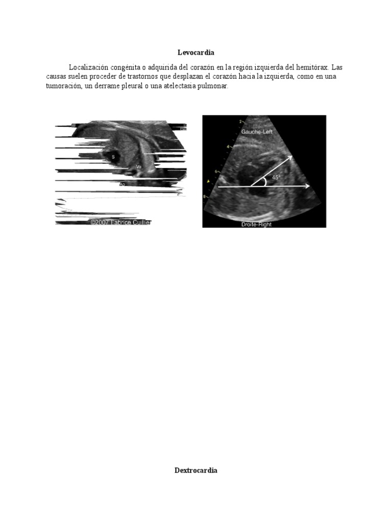 Levocardia | PDF | Especialidades Medicas | Enfermedades y trastornos