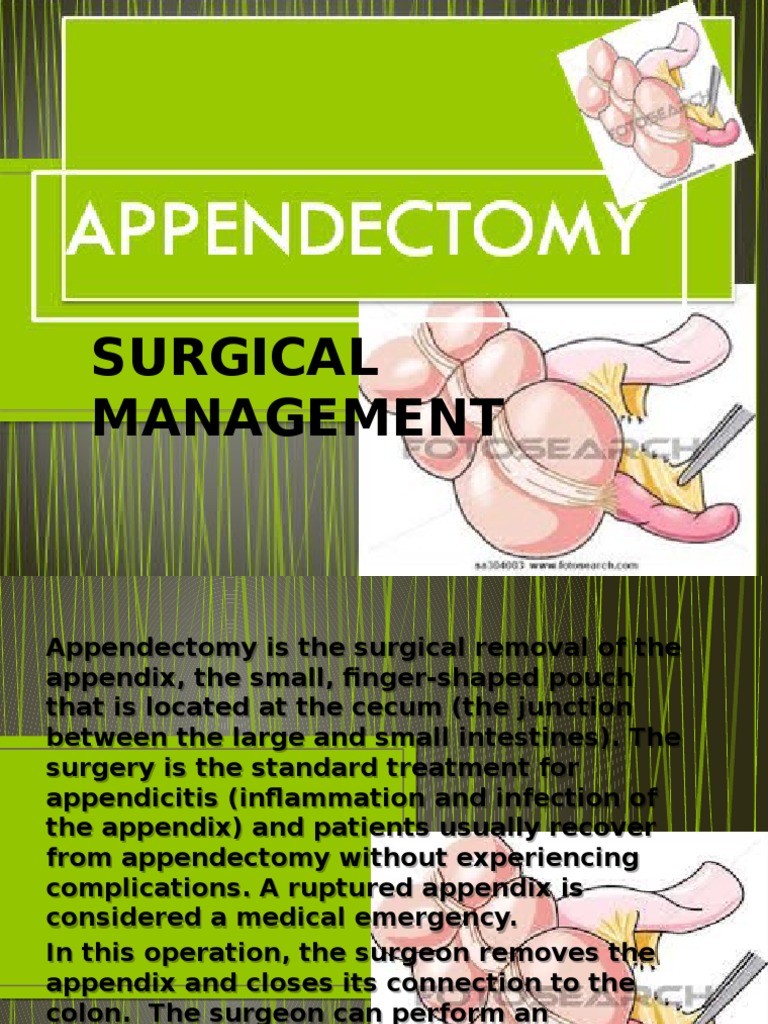 Appendectomy Case Presentation | PDF | Surgery | Medicine