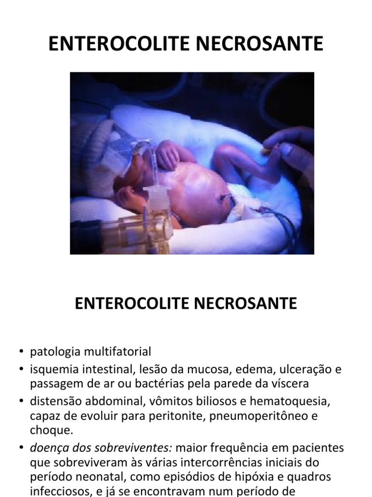 Enterocolite Necrosante | PDF | Sepse | Leite