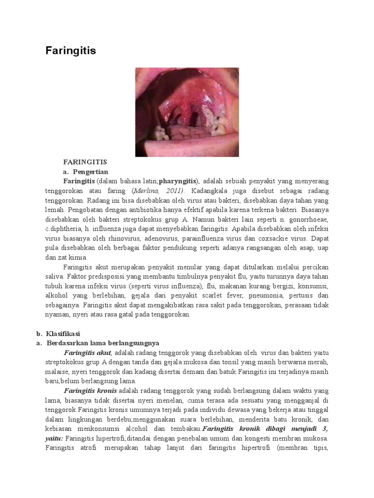 LARINGITIS AKUT Dan KRONIK | PDF