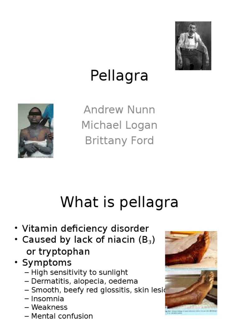 Understanding Pellagra Symptoms | PDF | Science & Mathematics | Lifestyle