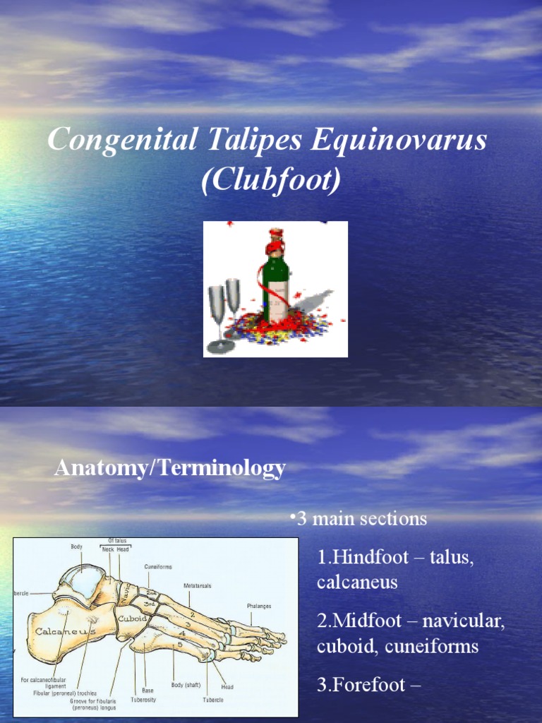 Understanding Congenital Clubfoot | PDF | Foot | Ankle