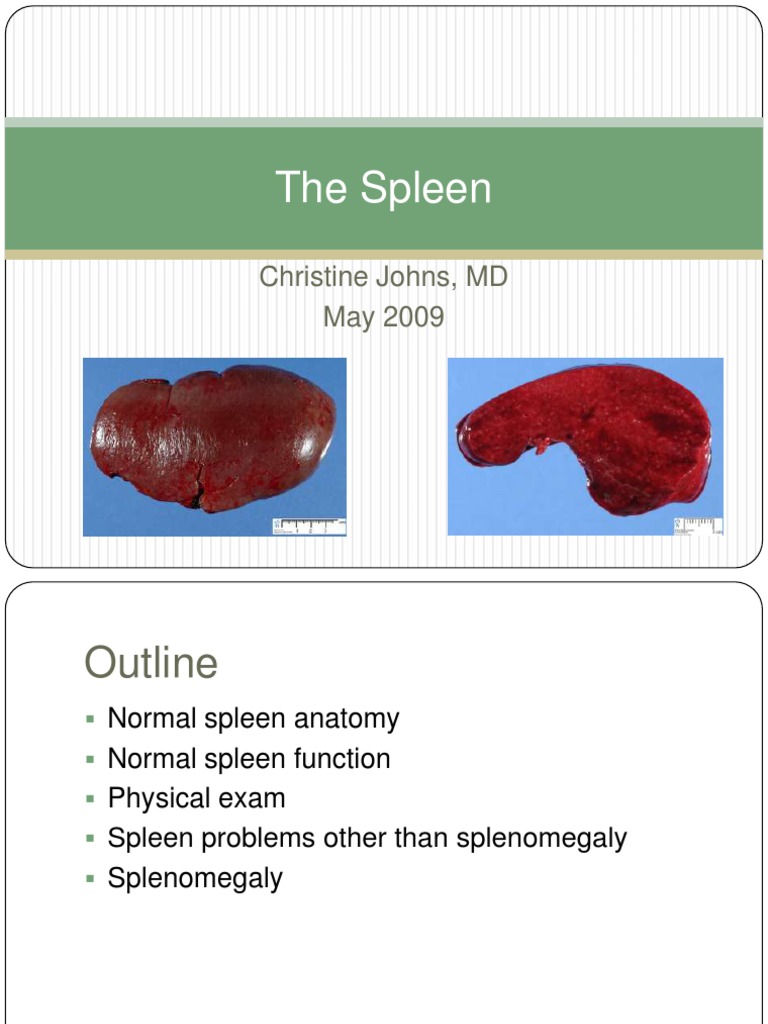 The Spleen | Spleen | Lymphatic System