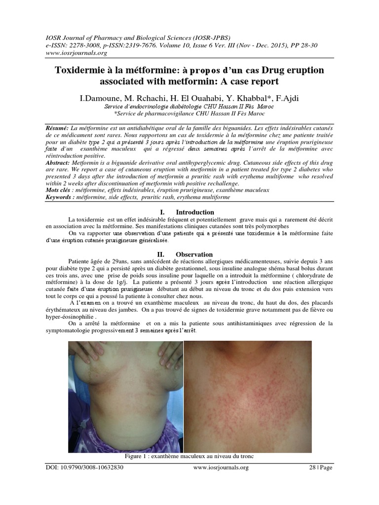 Toxidermie À La Métformine: À Propos D'un Cas Drug Eruption Associated ...