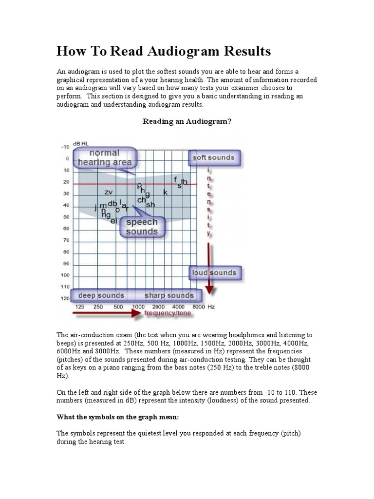Understanding Audiogram Results | PDF | Hearing Loss | Hearing