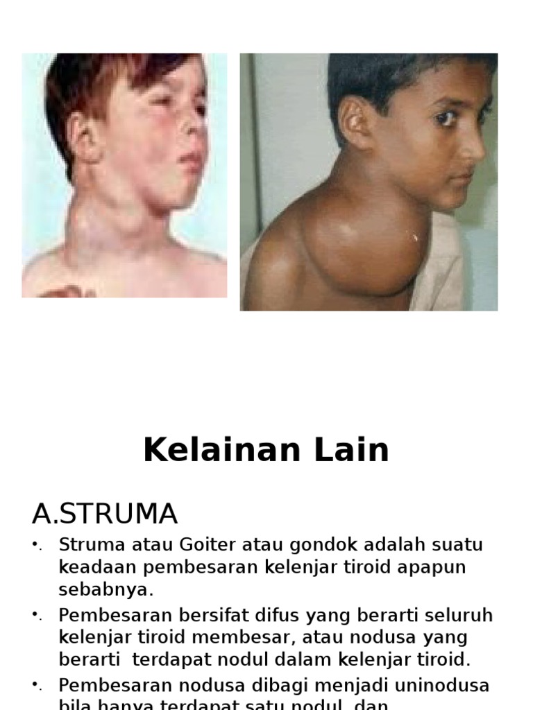 KELENJAR LIMFE LEHER | PDF