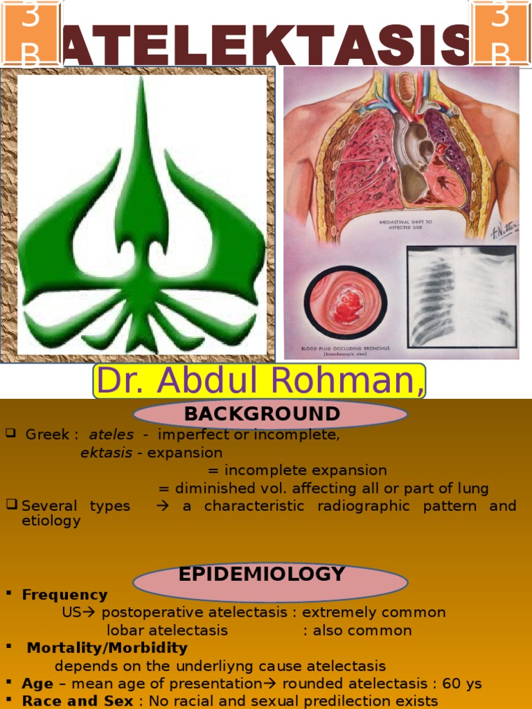 Atelectasis | PDF | Lung | Respiratory Diseases