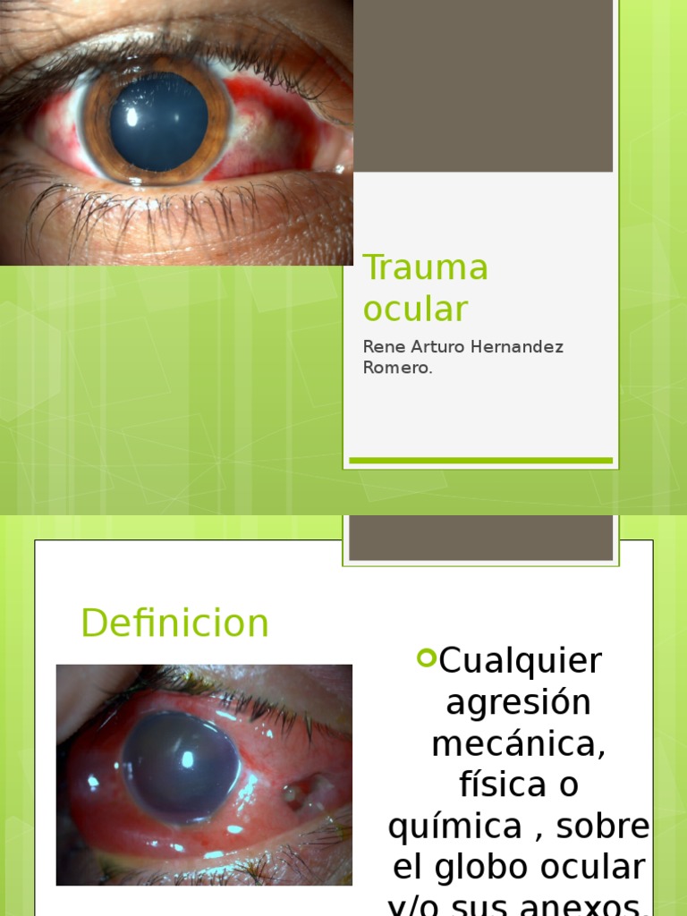 Clasificación y manejo del trauma ocular | PDF | Lesión | Ojo humano