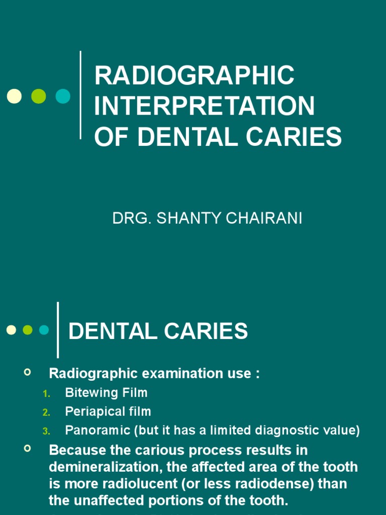 Dental Caries | PDF | Tooth Enamel | Dentistry Branches