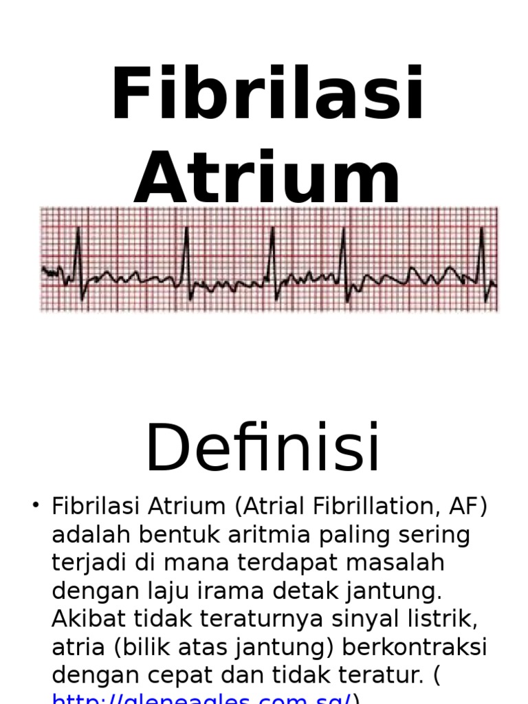Fibrilasi Atrium | PDF