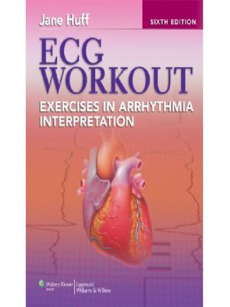 ECG Workout - Excercises in Arrhythmia Interpretation | PDF | Heart ...