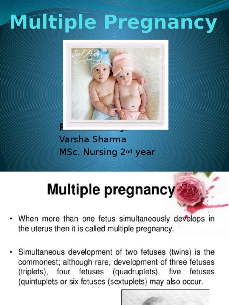 Managing Multiple Pregnancies: A Comprehensive Review of Risks ...