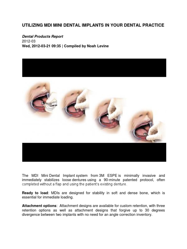 MDI Mini Dental Implants Overview | PDF | Business | Computers
