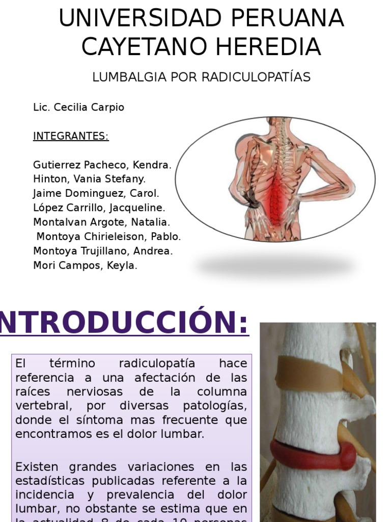 Lumbalgia Por Radiculopatia Powerpoint | PDF | Vértebra | Dolor lumbar