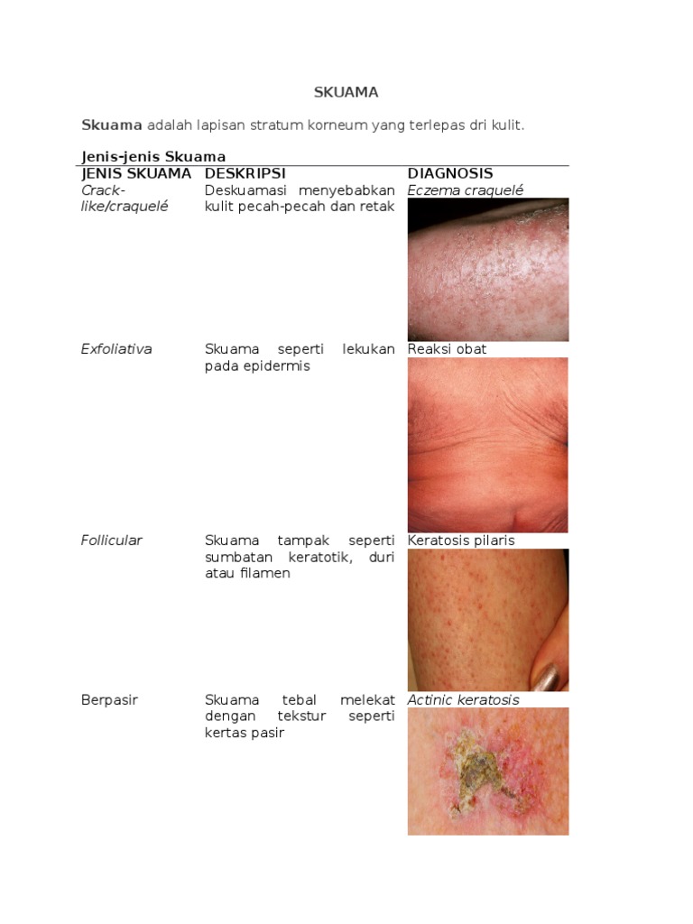 Jenis Squama | PDF | Sejarah