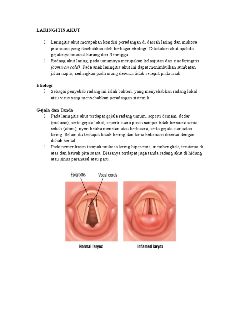 Laringitis Akut | PDF