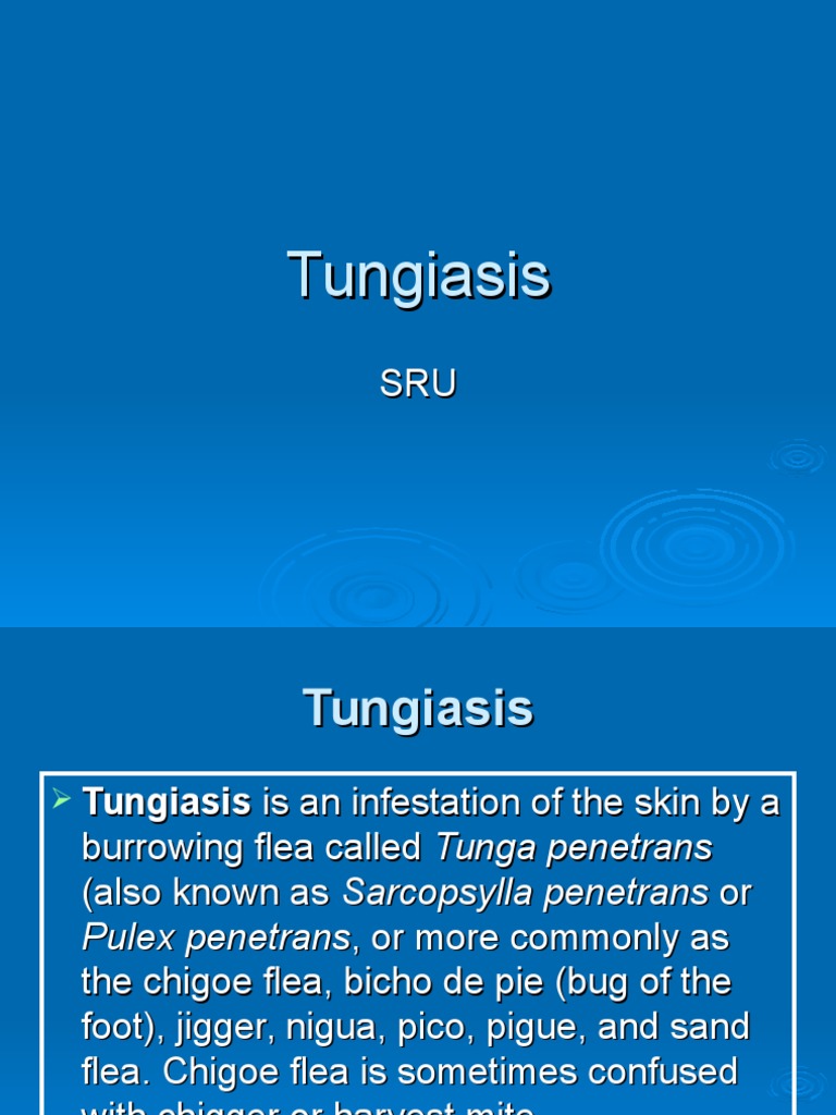 Tungiasis: Chigoe Flea Infestation Guide | PDF | Medical Specialties ...
