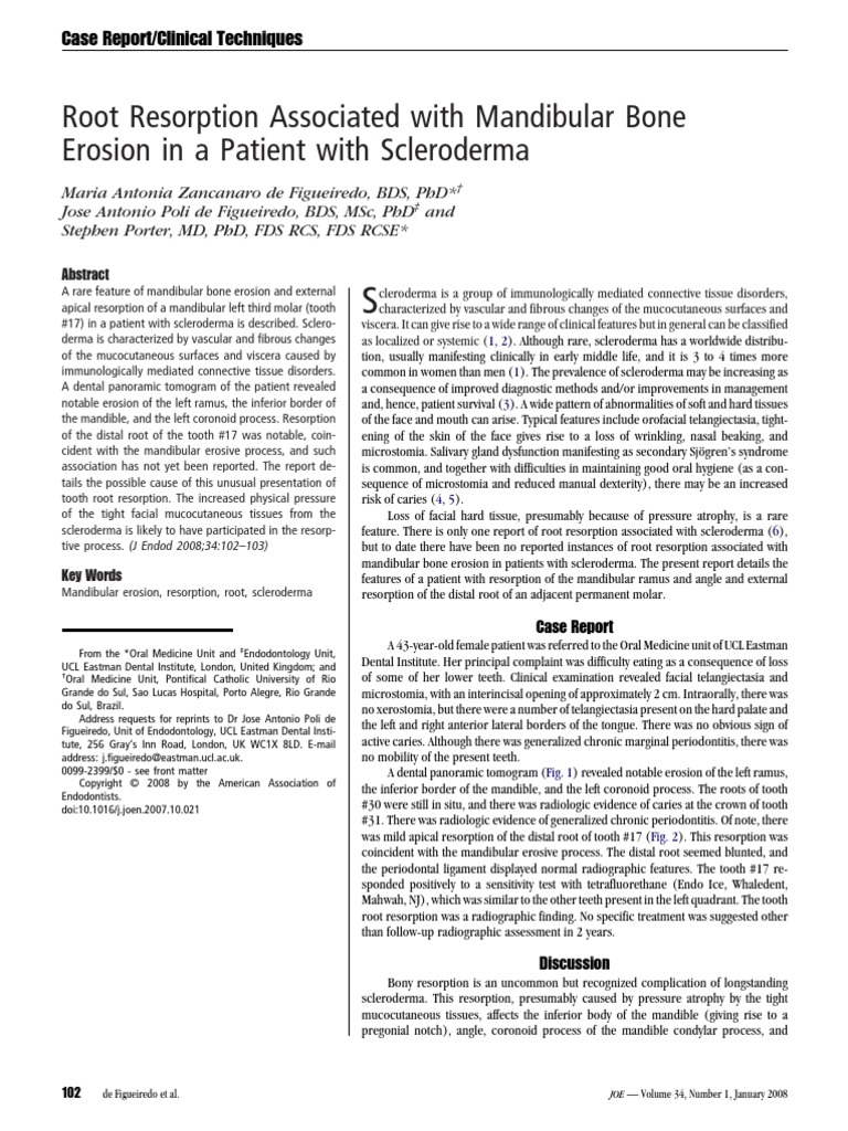 Scleroderma PDF | PDF | Human Tooth | Periodontology