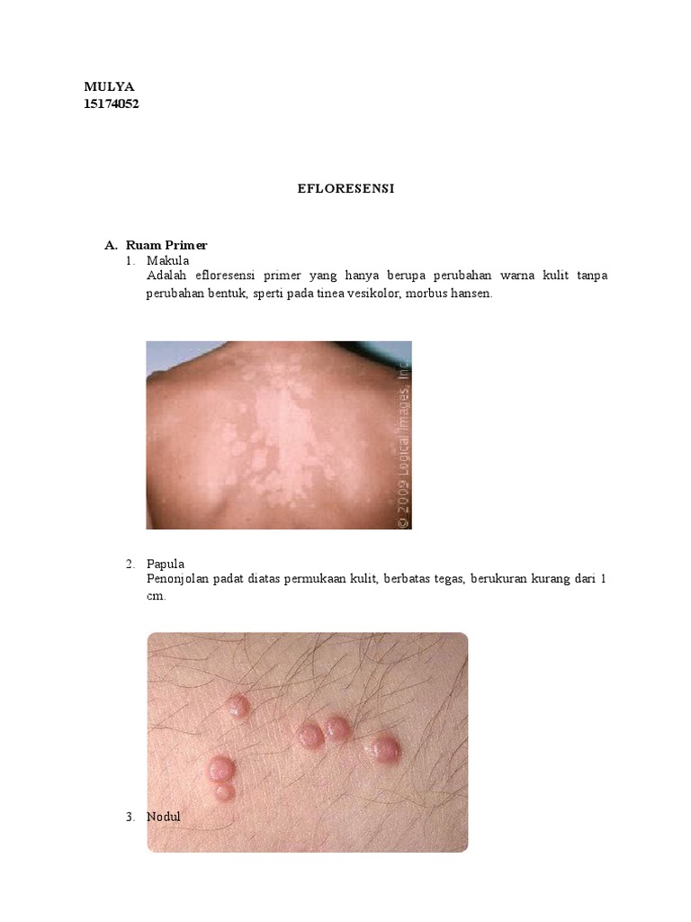 Ujud Kelainan Kulit | PDF