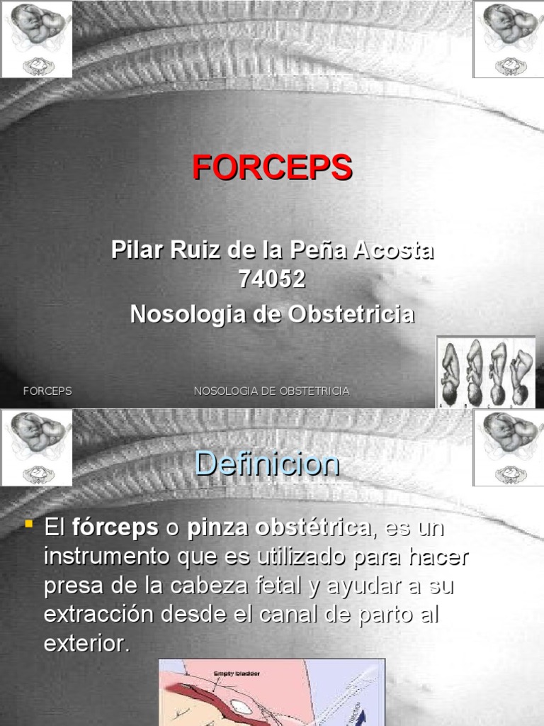 FORCEPS | PDF | Parto | Pelvis