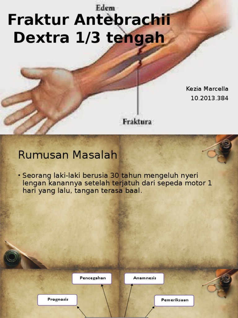 Fraktur Antebrachii Dextra - Kezia | PDF