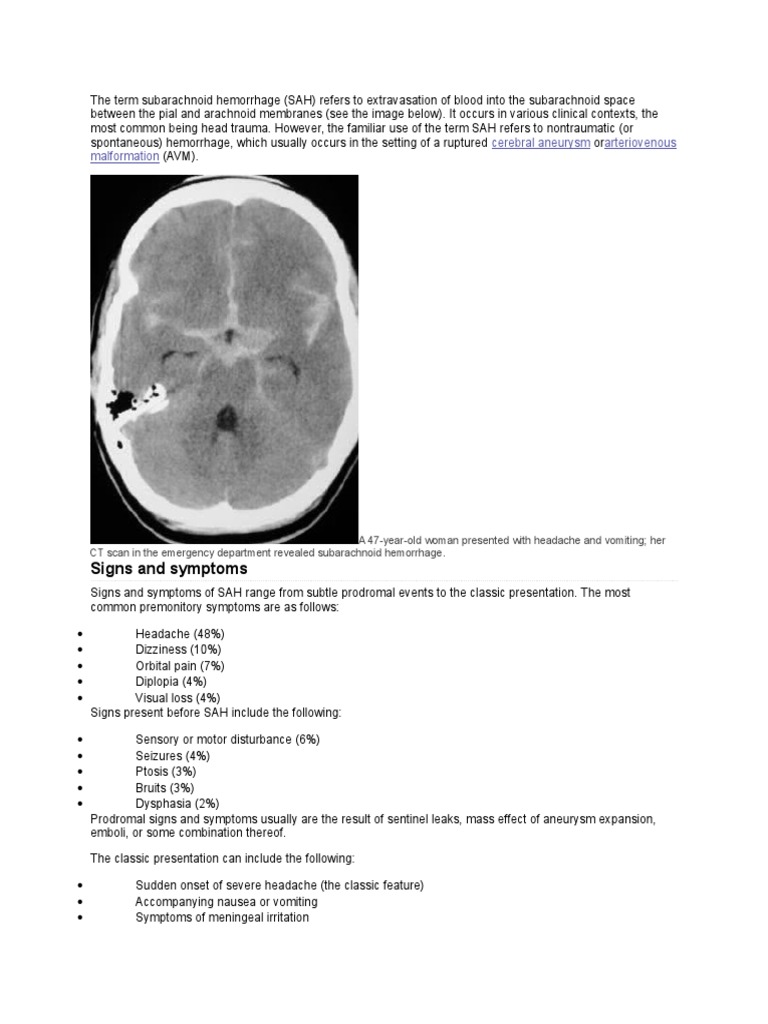 SAH DX | PDF | Angiography | Headache