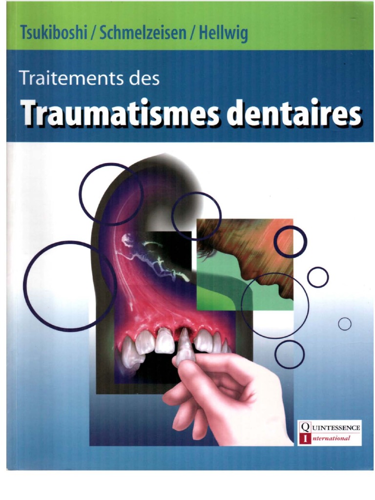 Traumatismes dentaires : Classification et traitements | PDF | Orthodontie | Émail dentaire
