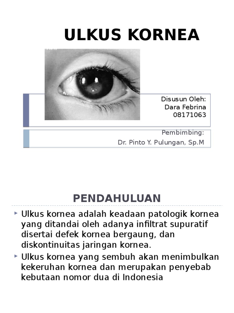 Ulkus Kornea | PDF