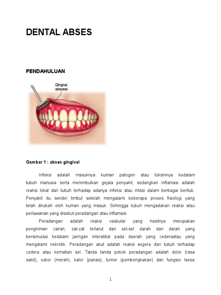 Referat Abses Gingiva | PDF