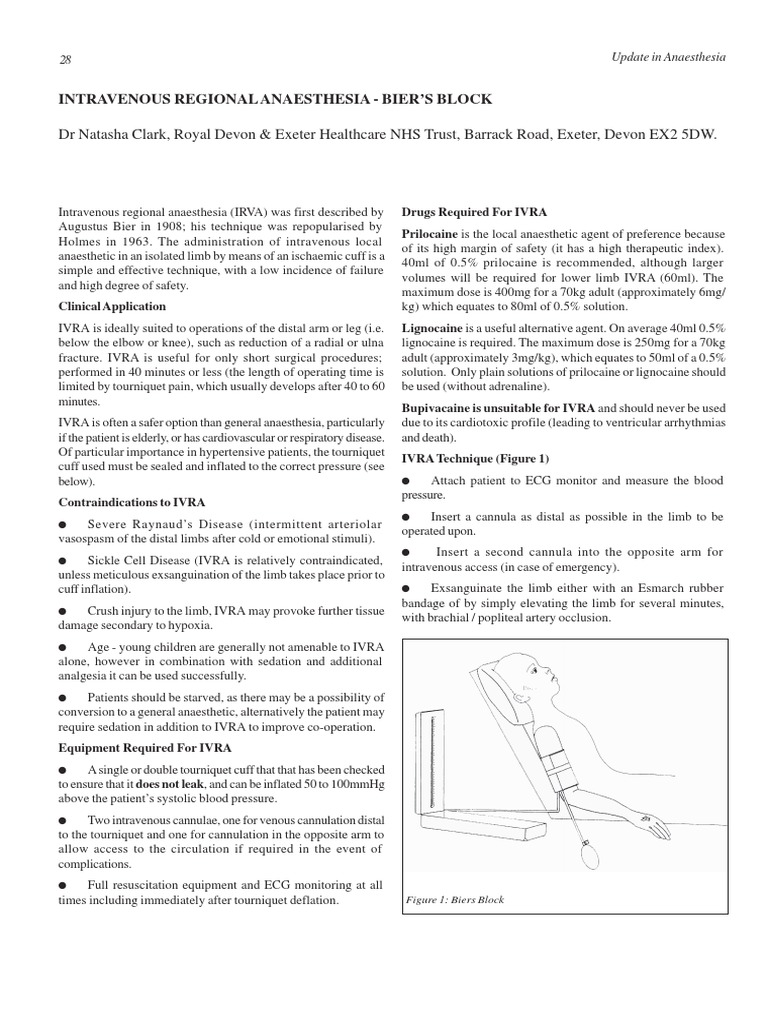 Intravenous Regonal Anaesthesia Biers Block | Anesthesia | Intravenous ...