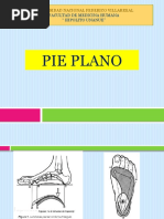Pie Talo, Pie Varo, Valgo, y Pie Plano | PDF | Pie | Tobillo