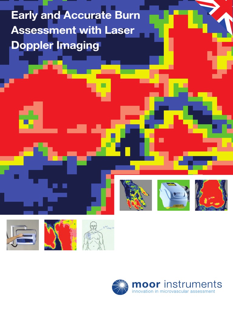 ENG Burns Brochure | PDF | Burn | Medical Ultrasound