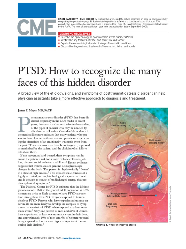 PTSD Etiology Signs Symptoms Neurobiology | Psychological Trauma ...