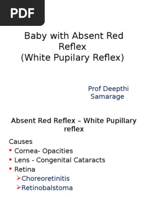 Absent Red Reflex