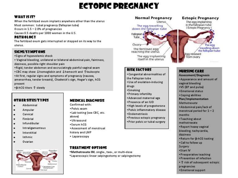 Ectopic Pregnancy | PDF