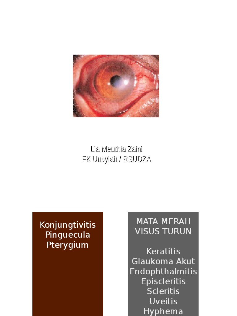 Mata Merah | Medical Specialties | Diseases And Disorders