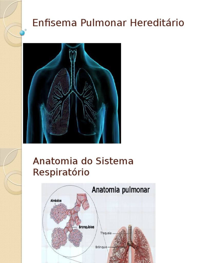 Enfisema Pulmonar | PDF | Doença de Obstrução Pulmonar Crônica | Pulmão