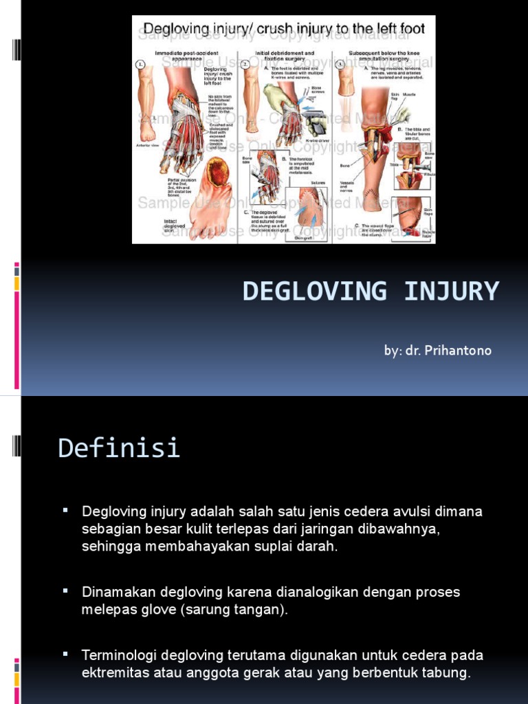 Cedera Degloving dan Penanganannya | PDF