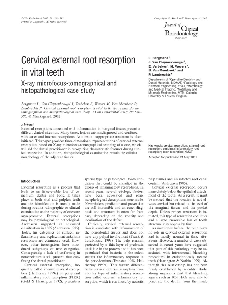 Cervical Resorption Leuven | PDF