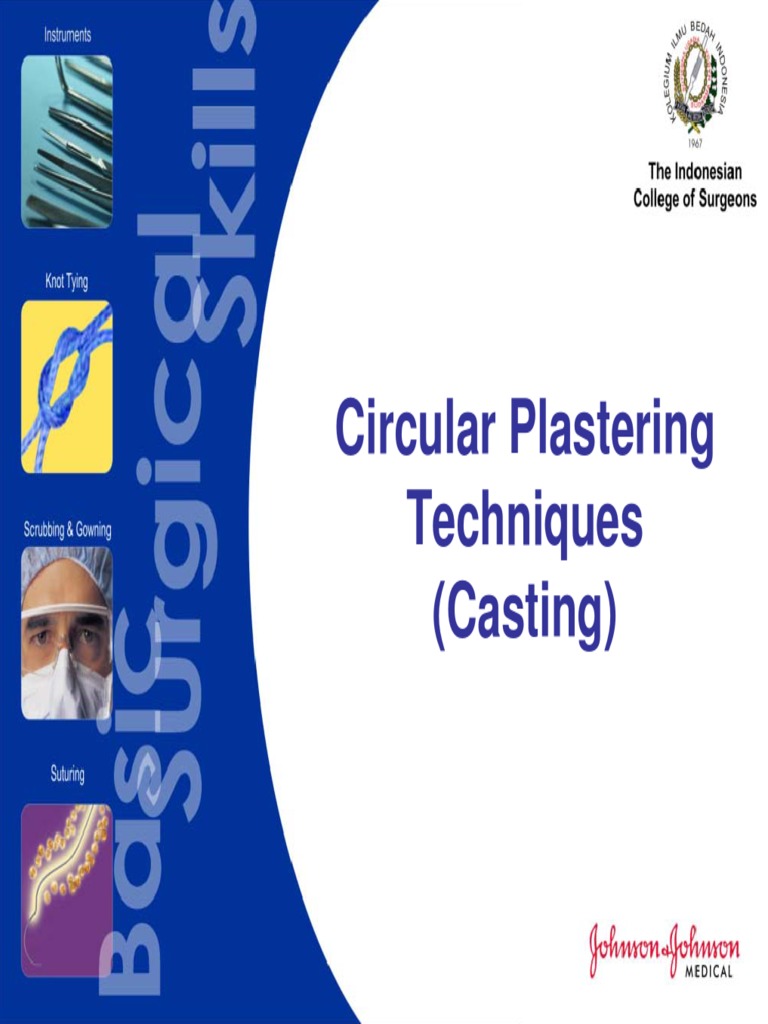 Circular Gips (Casting) | PDF