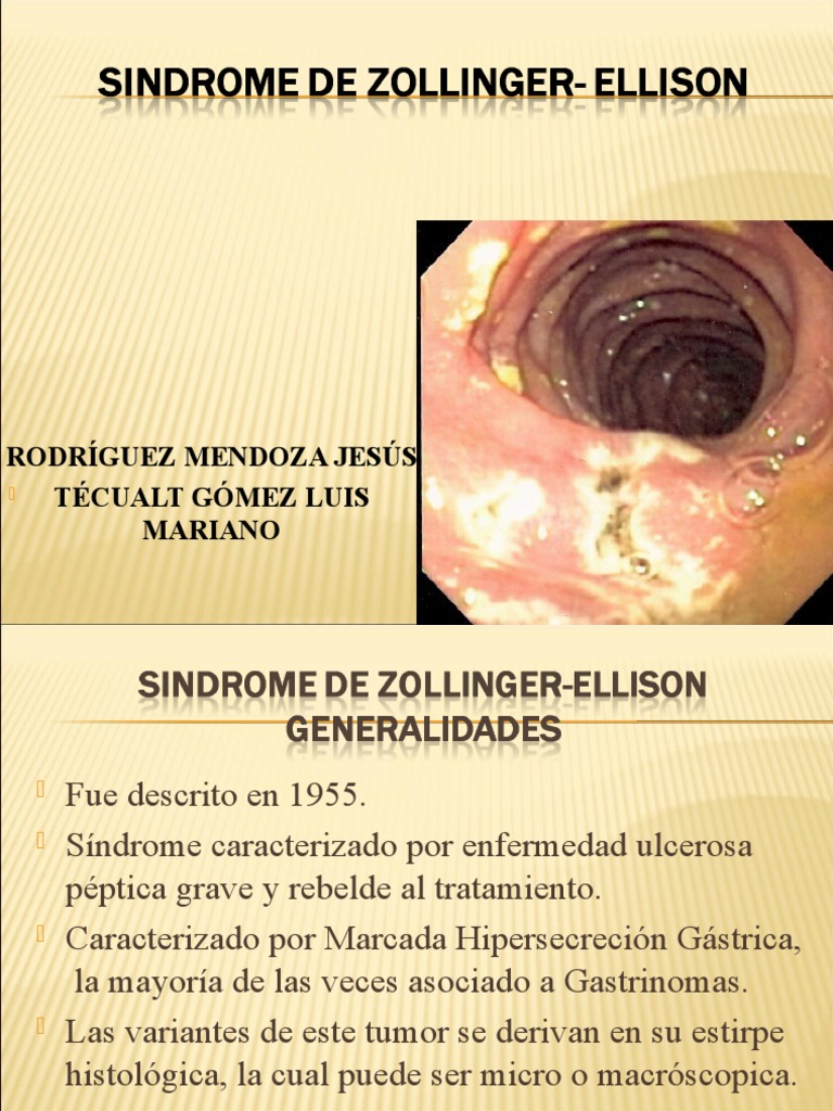 Sindrome de Zollinger-Ellison | PDF | Páncreas | Estómago