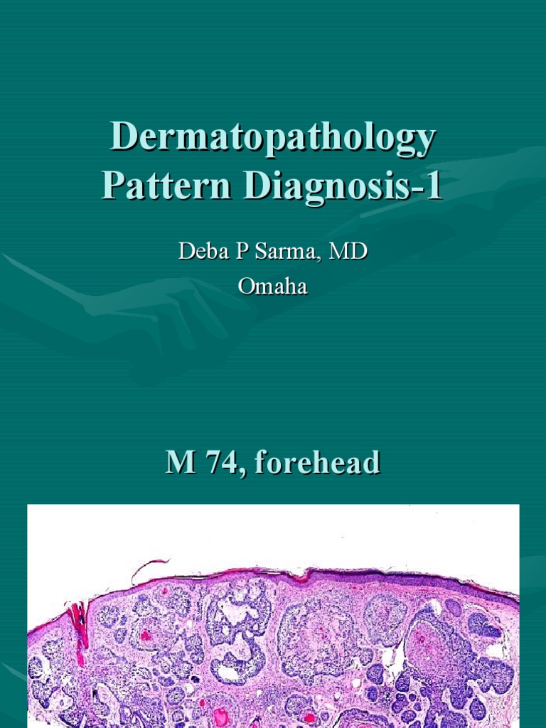 Dermatopathology Pattern Diagnosis-1 | PDF