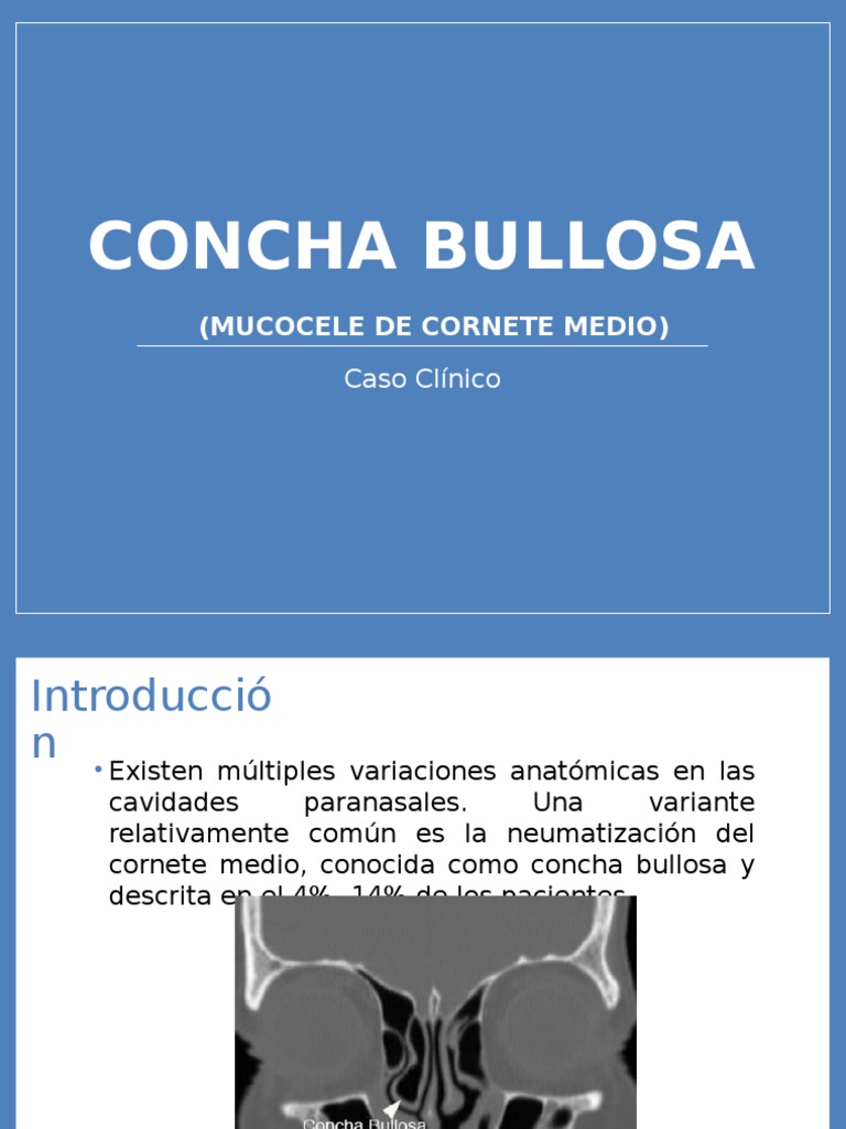 Comment Soigner Une Concha Bullosa – FJCY