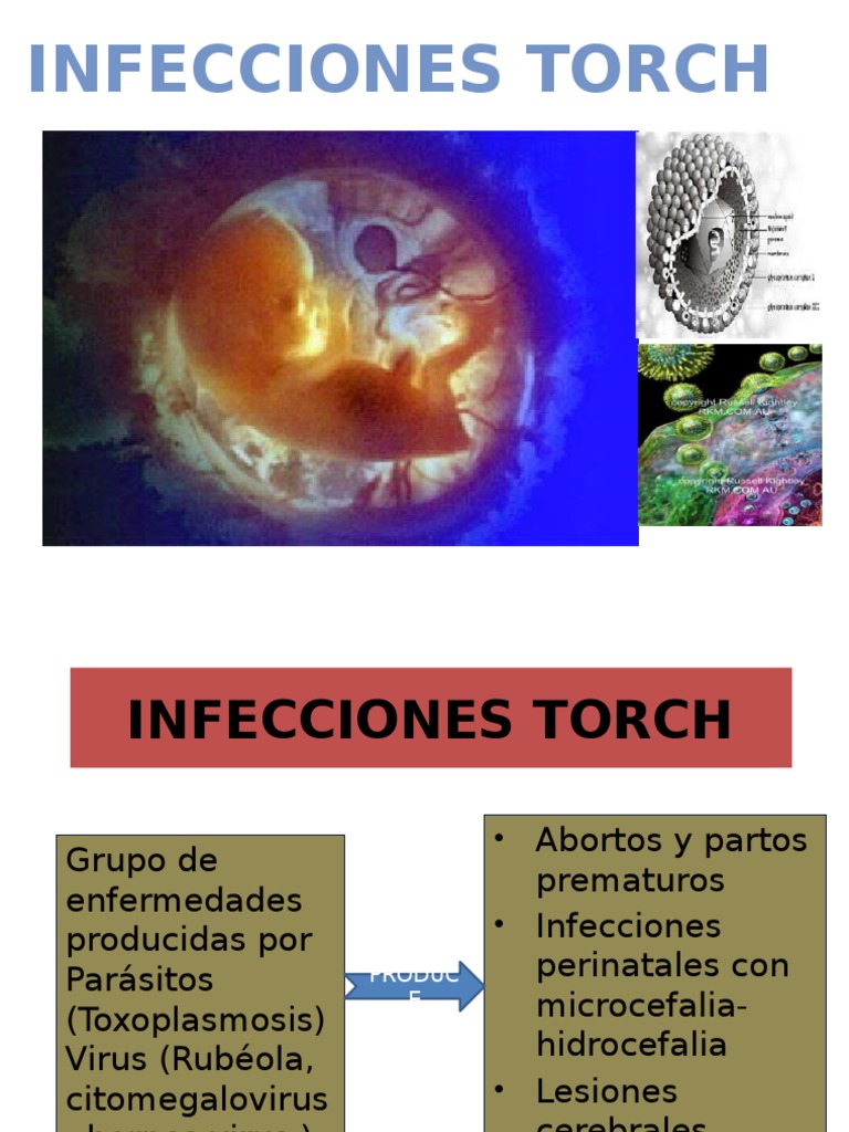 INFECCIONES TORCH.pptx | Especialidades Medicas | Enfermedades y ...