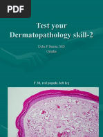 Severity Scoring of Atopic Dermatitis Index SCORAD PDF | PDF ...