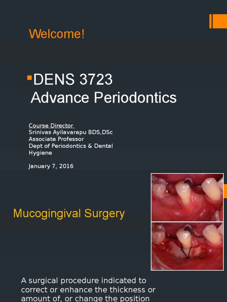 Mucogingival Surgery I | Mouth | Medical Specialties